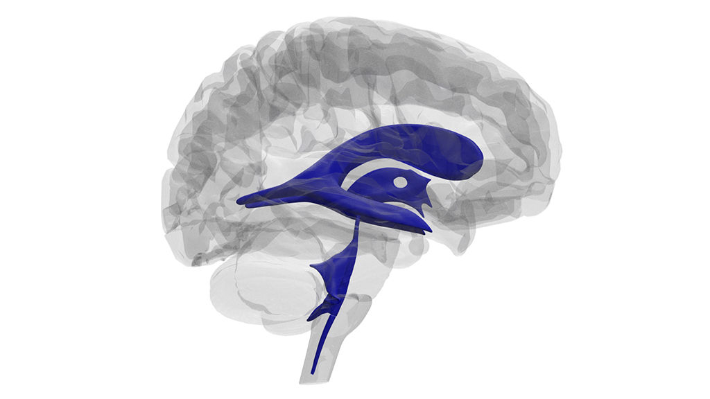 Exploring the Ventricles of the Brain Using a Four-Step Systematic ... Exploring the Ventricles of the Brain Using a Four-Step Systematic ...