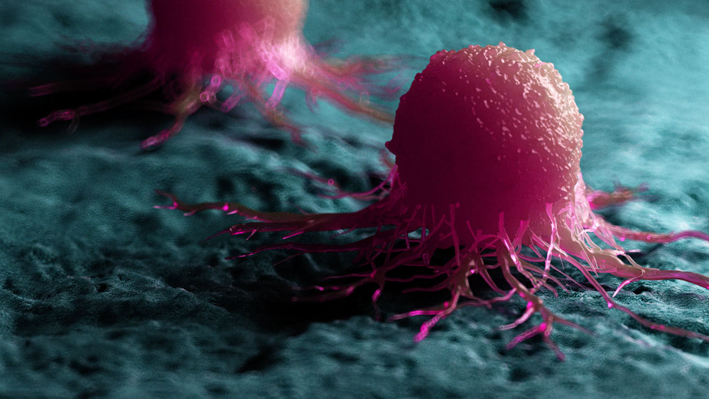 How Are Cancer Cells Different From Normal Cells? | NSTA