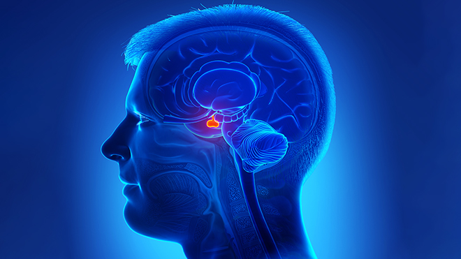 Pituitary Perplexity | NSTA